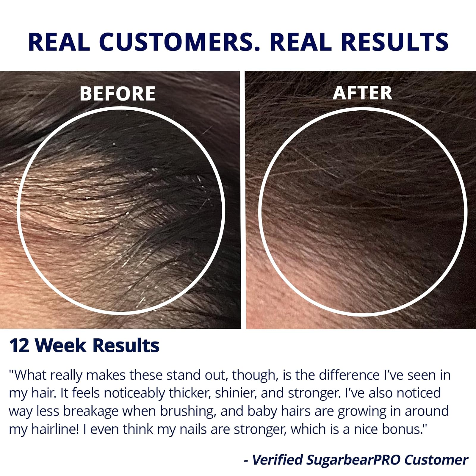 hair vitamins for men and women