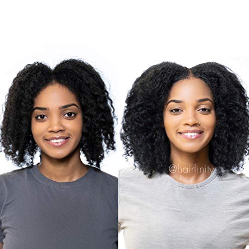 hairfinity for stronger hair follicles
