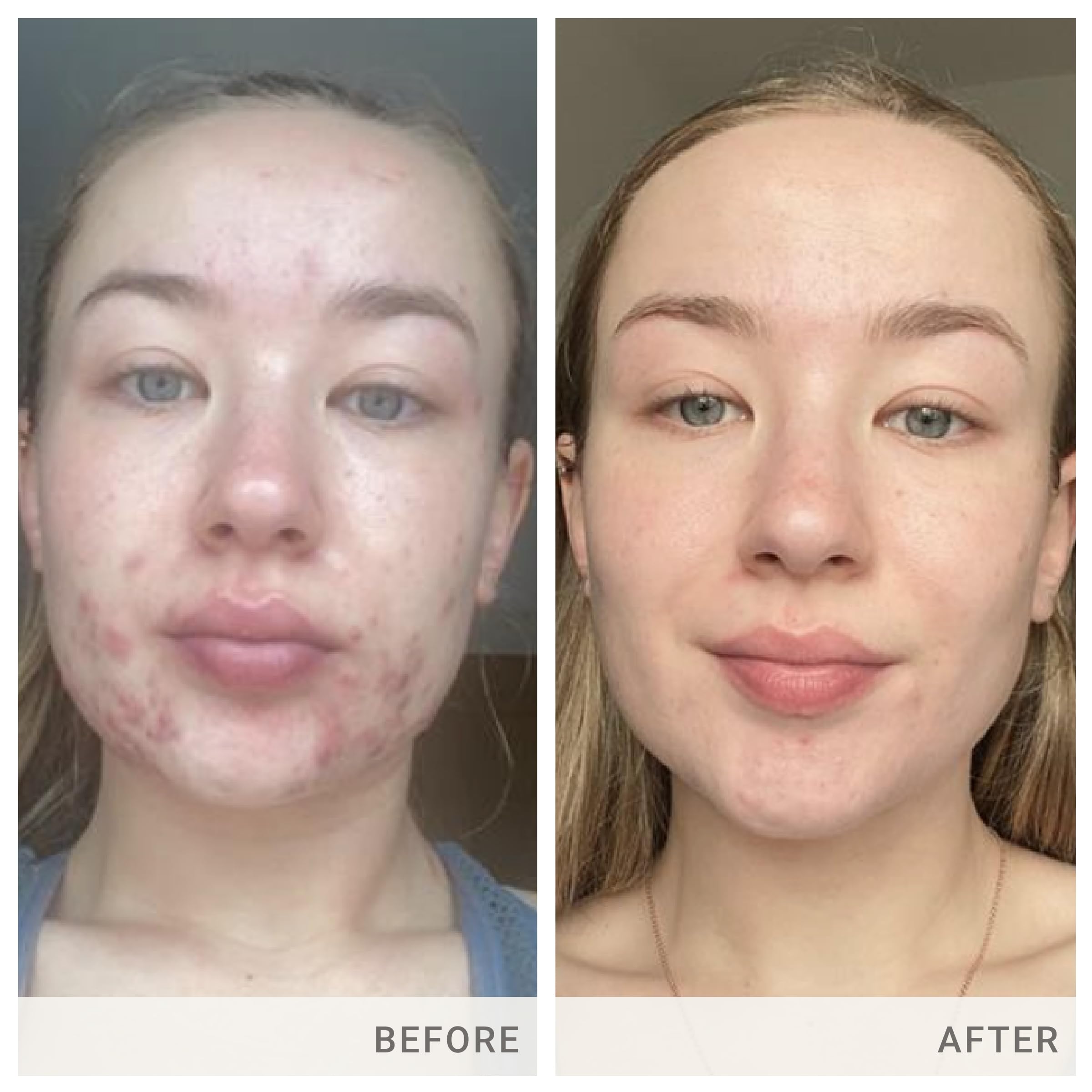 healthy skin nutritional support capsules