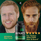 Helix Heal saw palmetto benefits