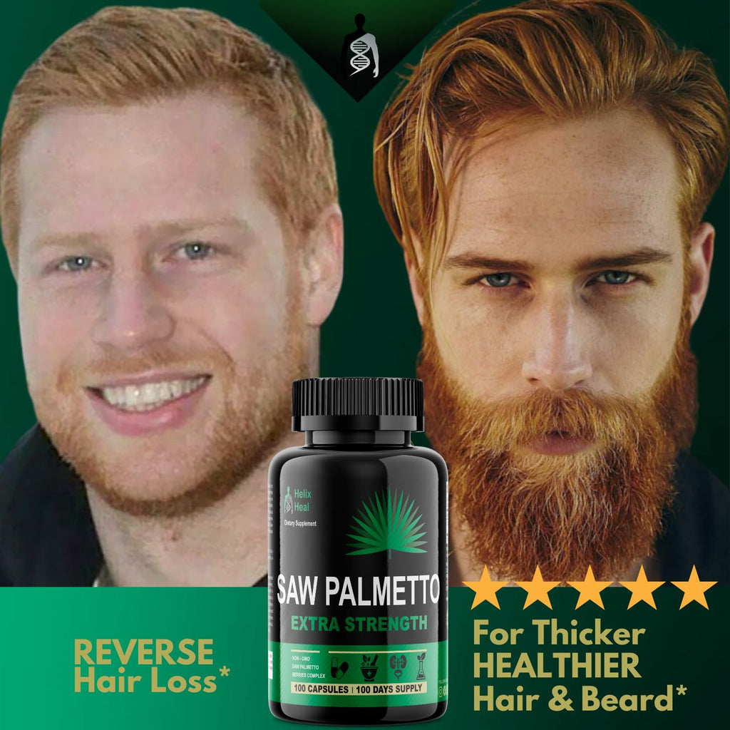 herbal supplement for prostate support