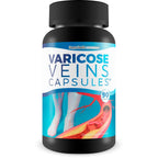 herbal supplement for varicose veins