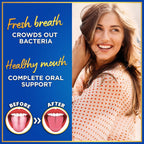 high CFU probiotics for oral hygiene