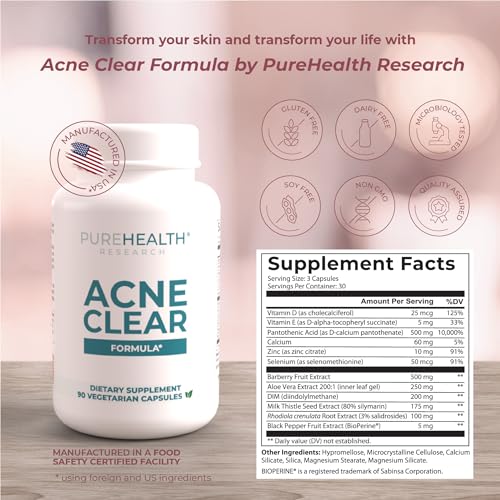 holistic approach to acne management