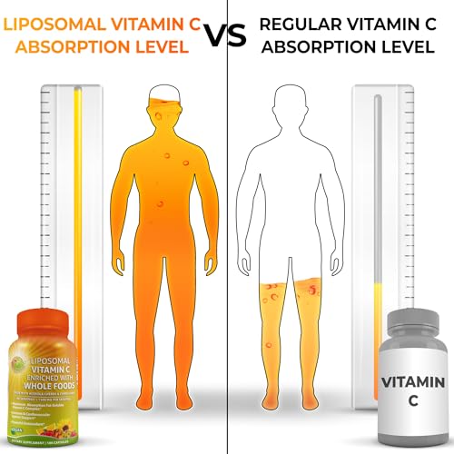 immune support vitamin c supplement