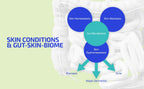 improve gut health with prebiotic formula