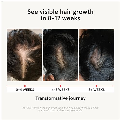 iRestore biotin supplement for growth