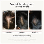 iRestore biotin supplement for growth
