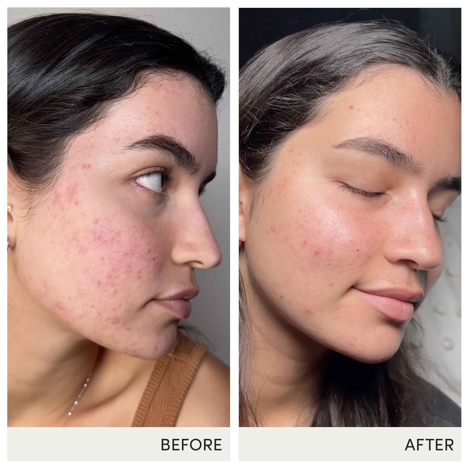 jane iredale Skin Accumax for clear complexion