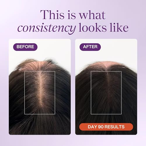 KeraLush vitamins for stronger hair