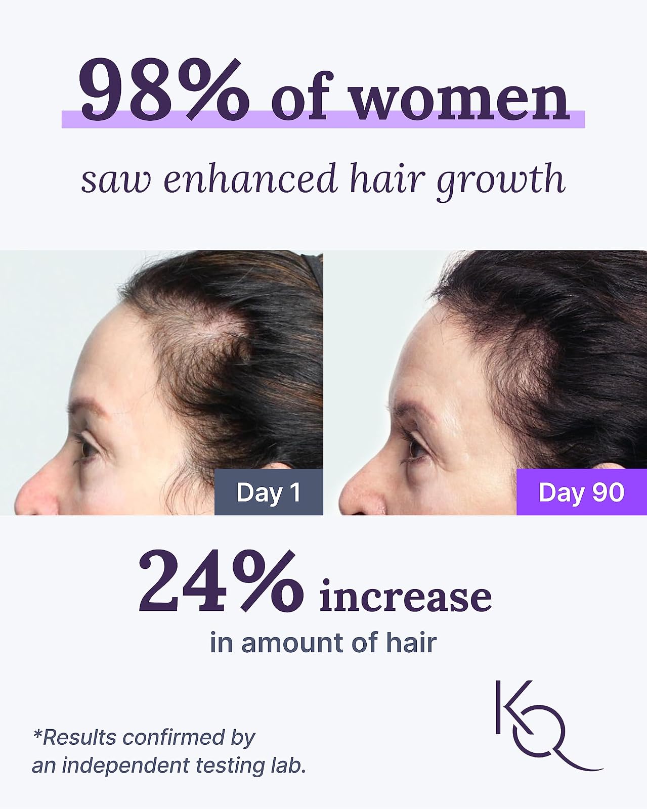 KeraViatin biotin scalp health formula
