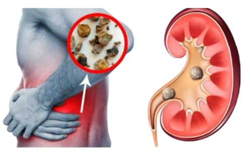 kidney health support with herbs