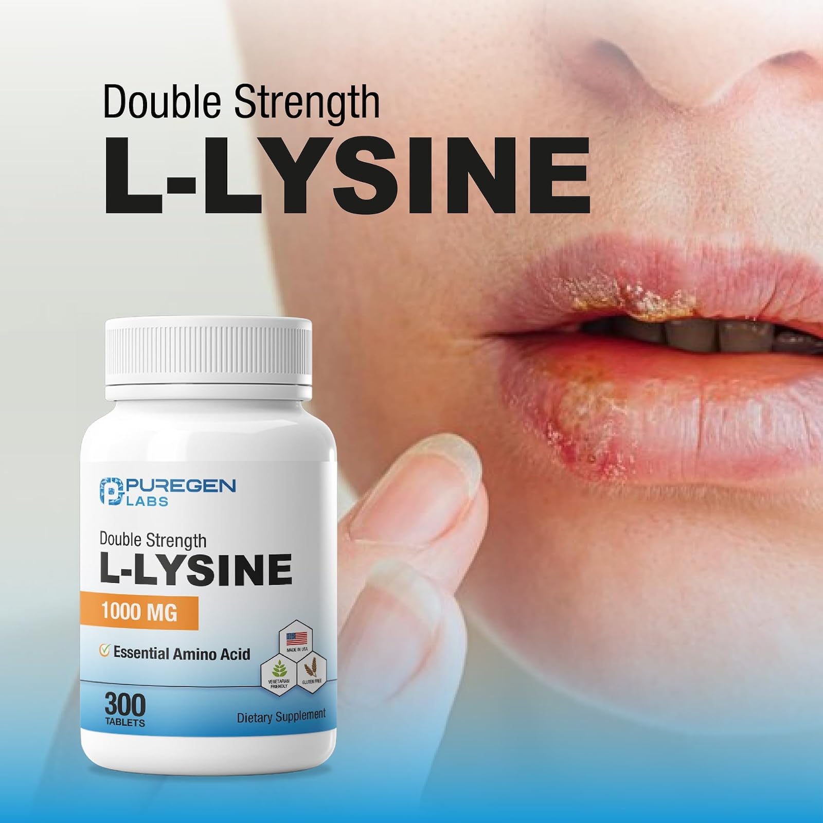 l-lysine tablets for cold sore relief