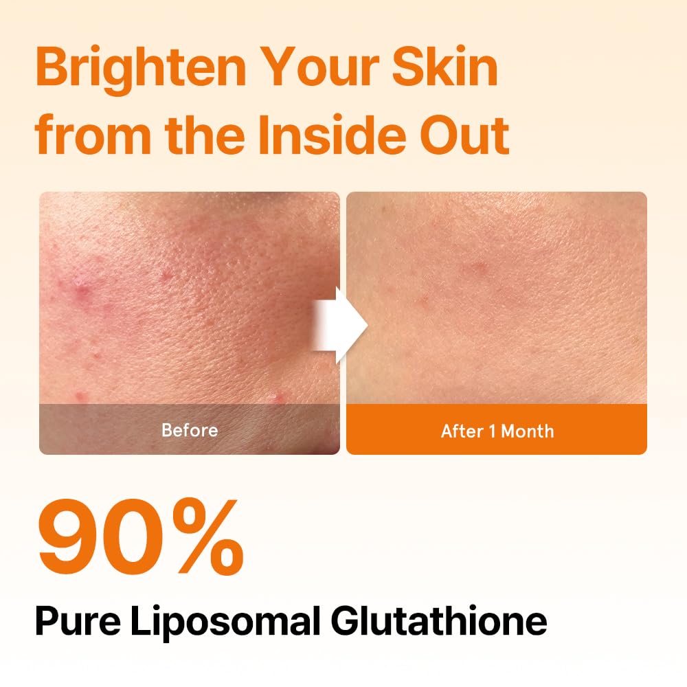 liposomal glutathione for immune support