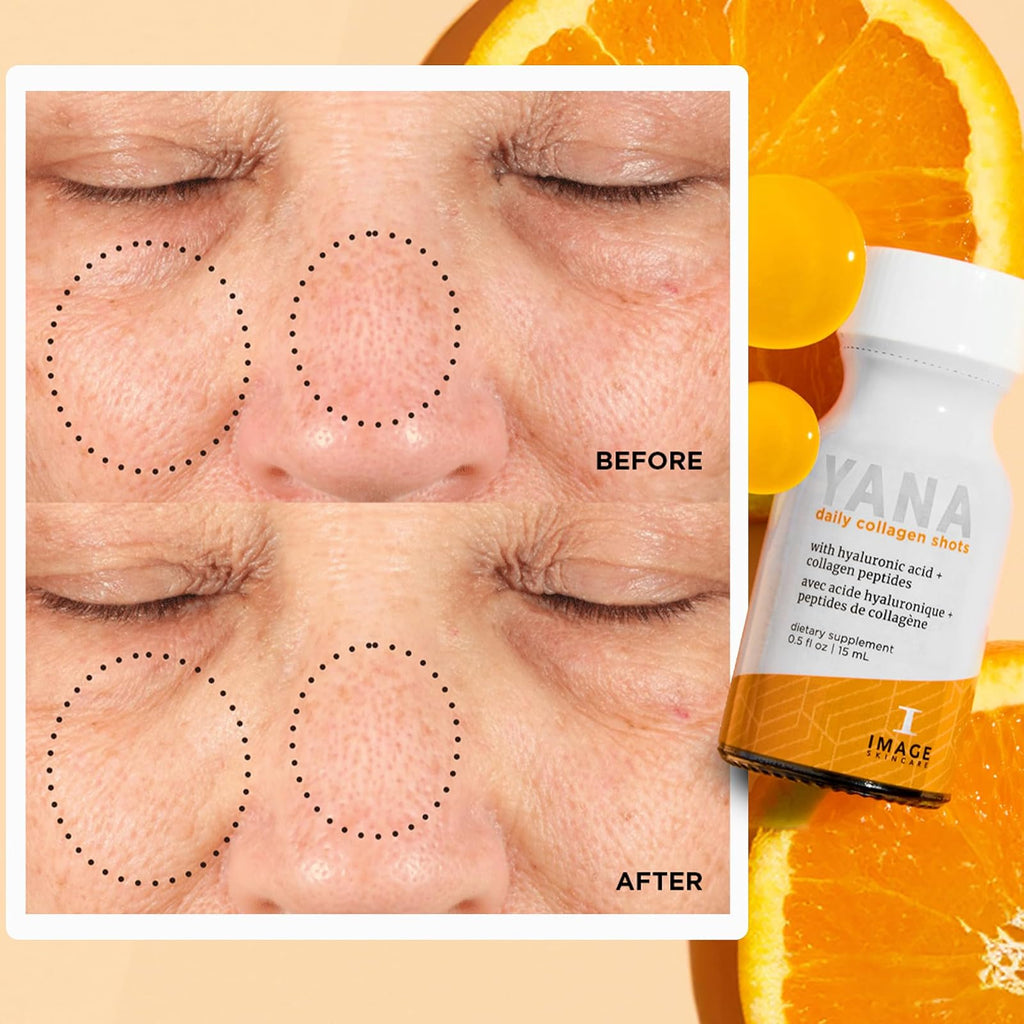 liquid collagen shots for hydration