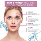 Low molecular weight hyaluronic acid