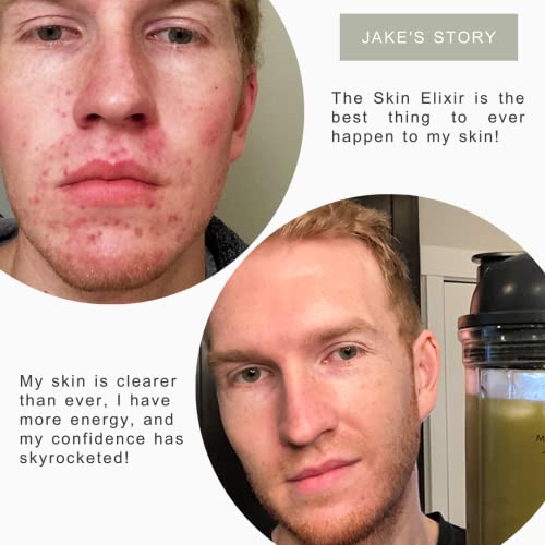 Lune vitamin supplements for healthy skin