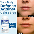 Lysine capsules for cold sore prevention