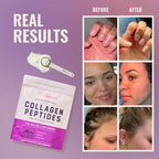 marine collagen for healthy skin