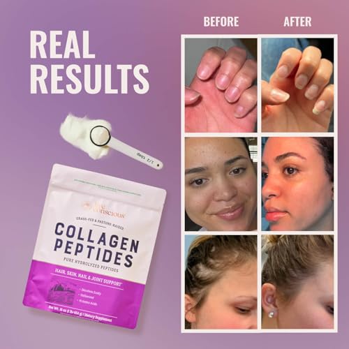 marine collagen for healthy skin