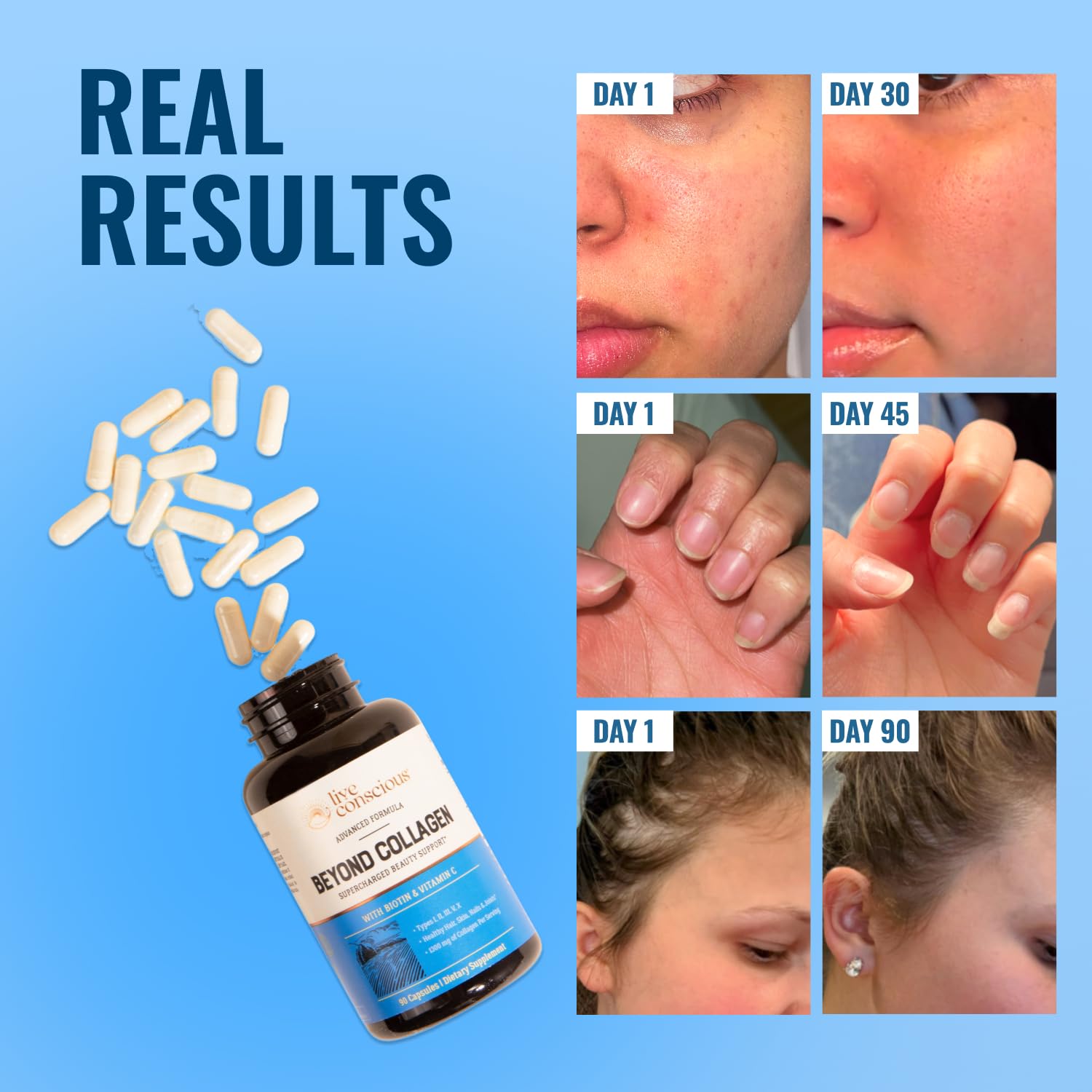 marine collagen for healthy skin