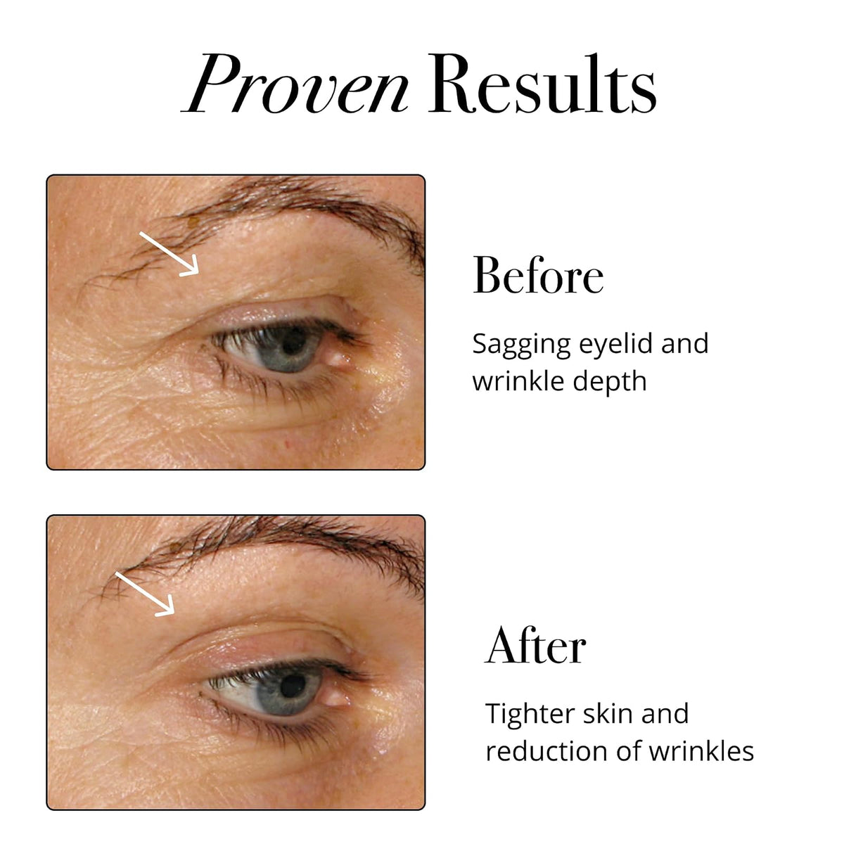 marine collagen for skin health