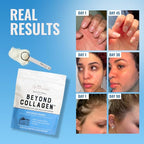 marine collagen for skin health