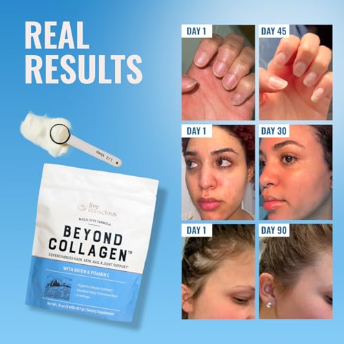 marine collagen for skin health
