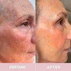 marine collagen for youthful appearance