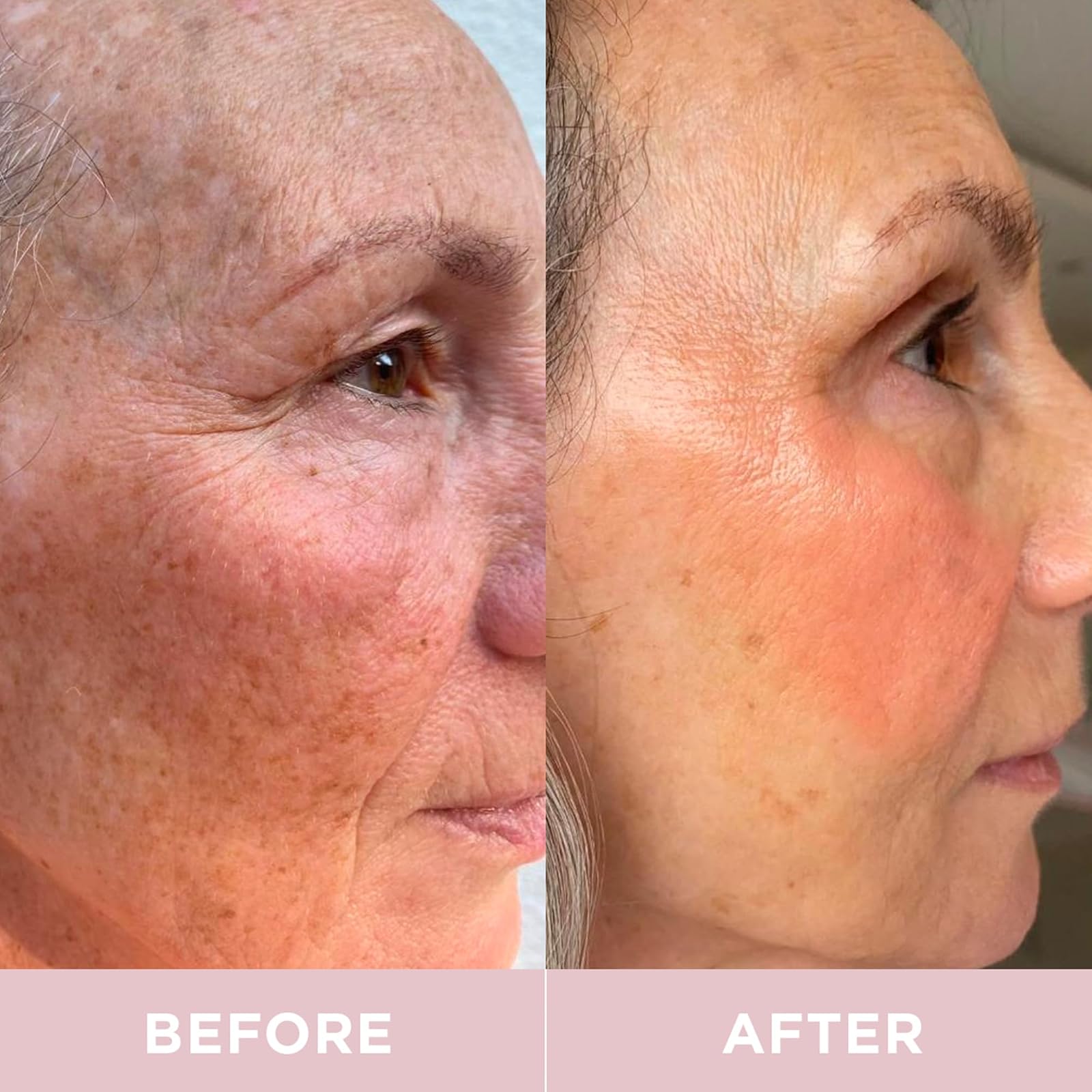 marine collagen for youthful appearance