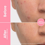 marine collagen gummies for youthful glow