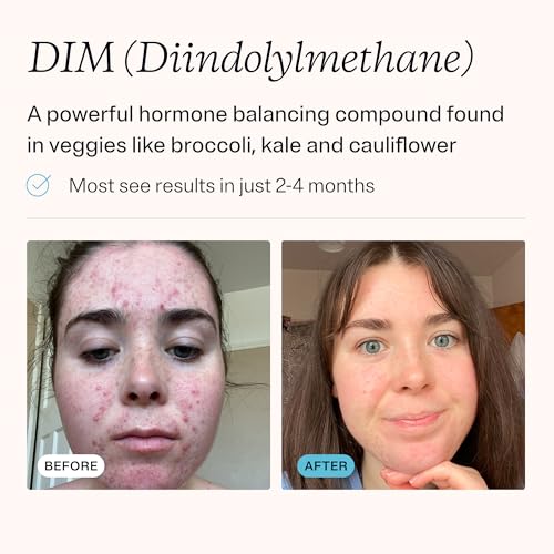 MDacne DIM capsules for clearer skin