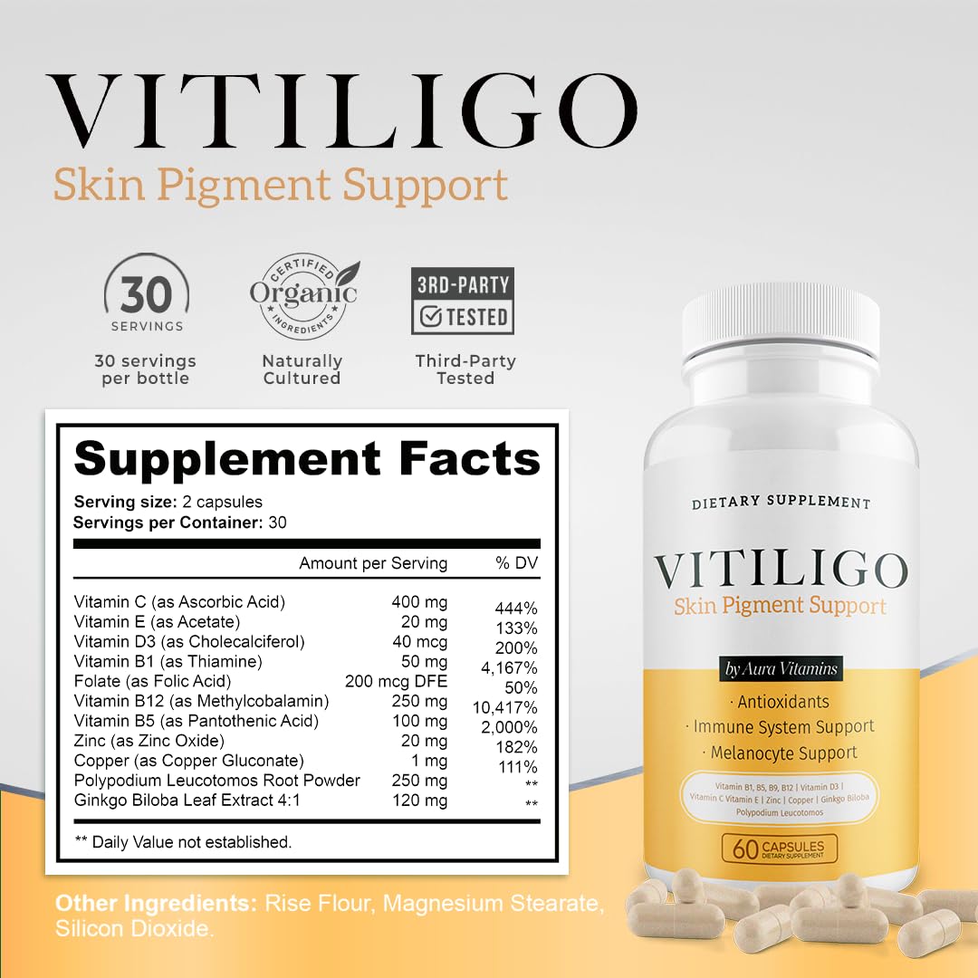 Mineral supplements for vitiligo management