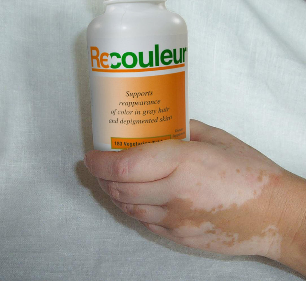 mineral support for vitiligo management