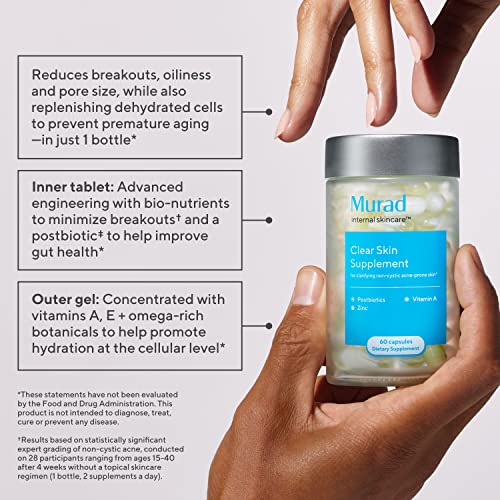 minimize breakouts with Murad supplements