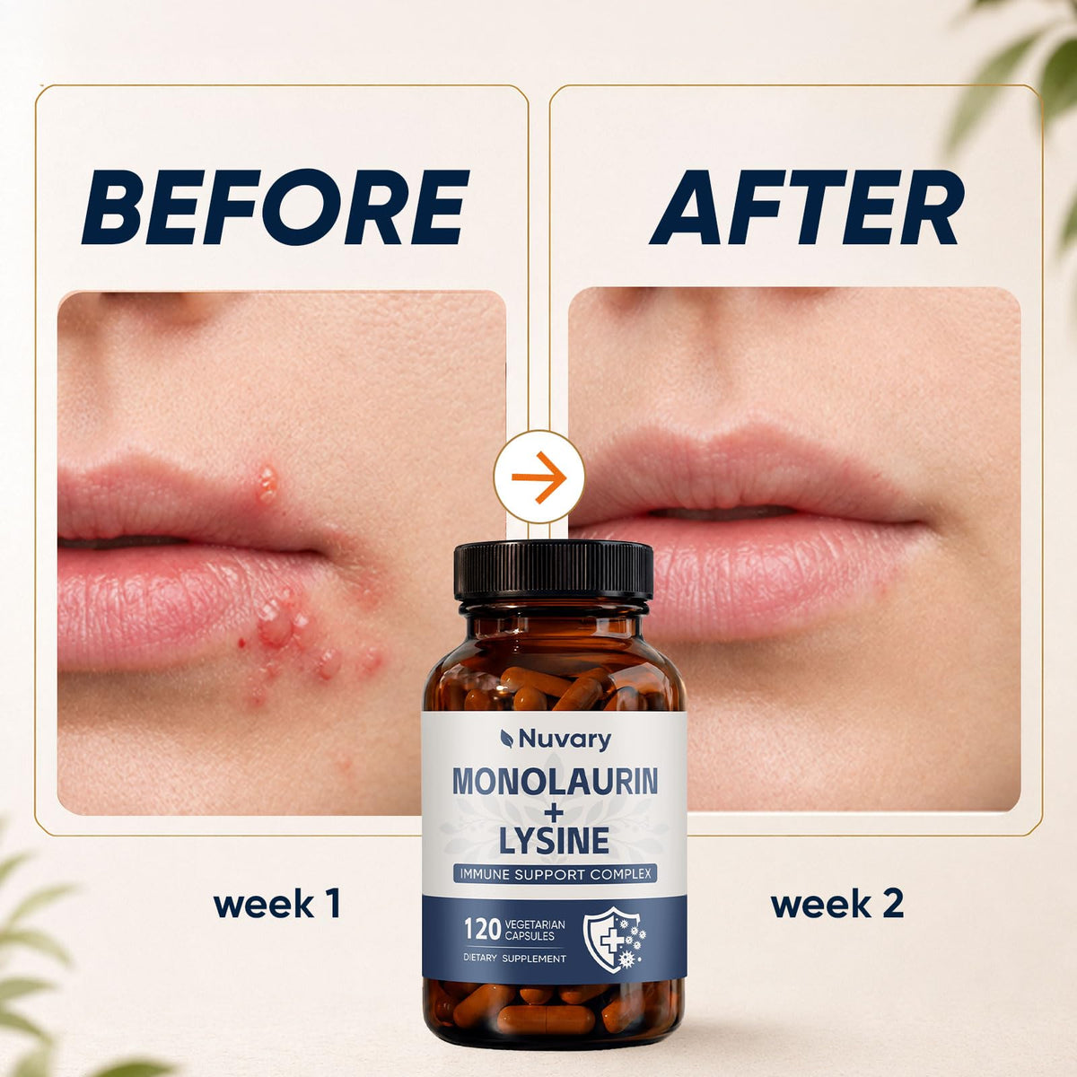 Monolaurin Lysine capsules for healthy skin