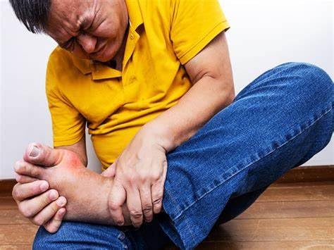 multivitamin for men with gout relief