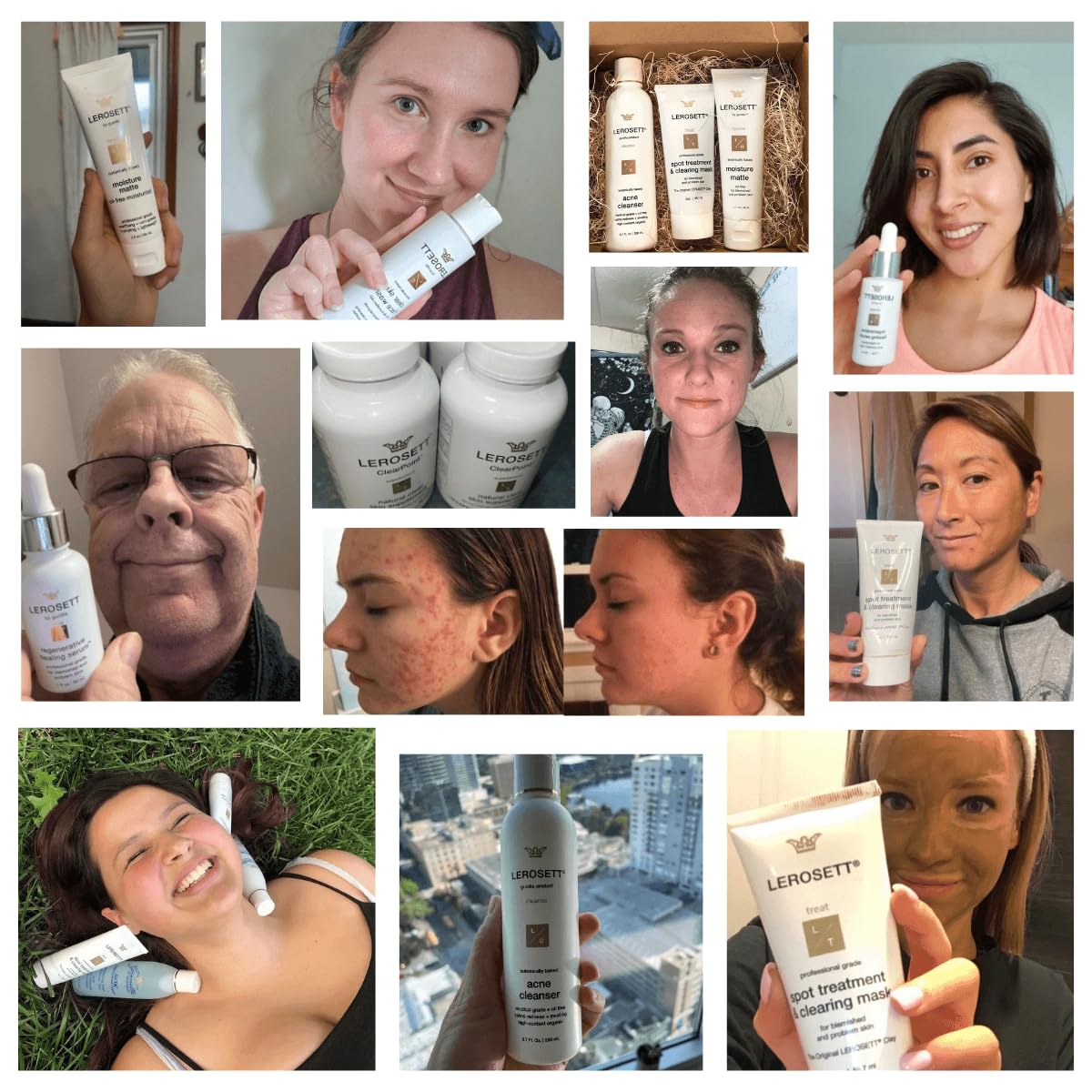 multivitamin for teens with acne