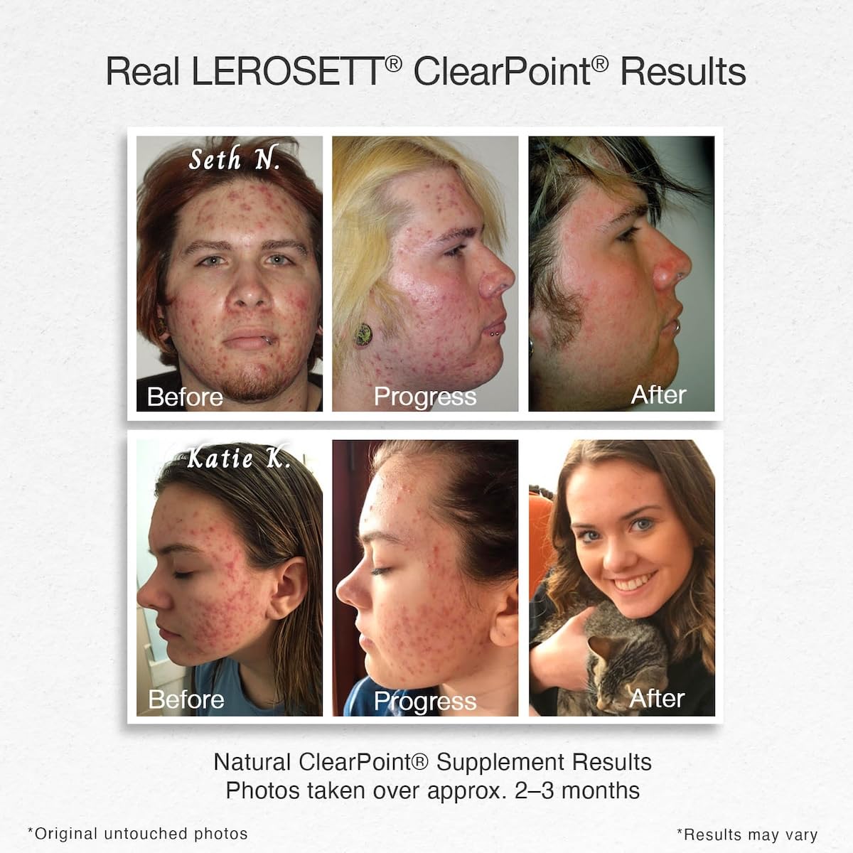 multivitamin for women with acne