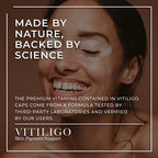 multivitamin for women with vitiligo support