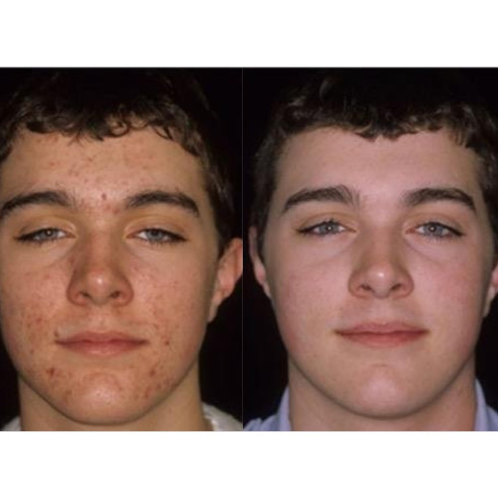 multivitamins for healthy skin support