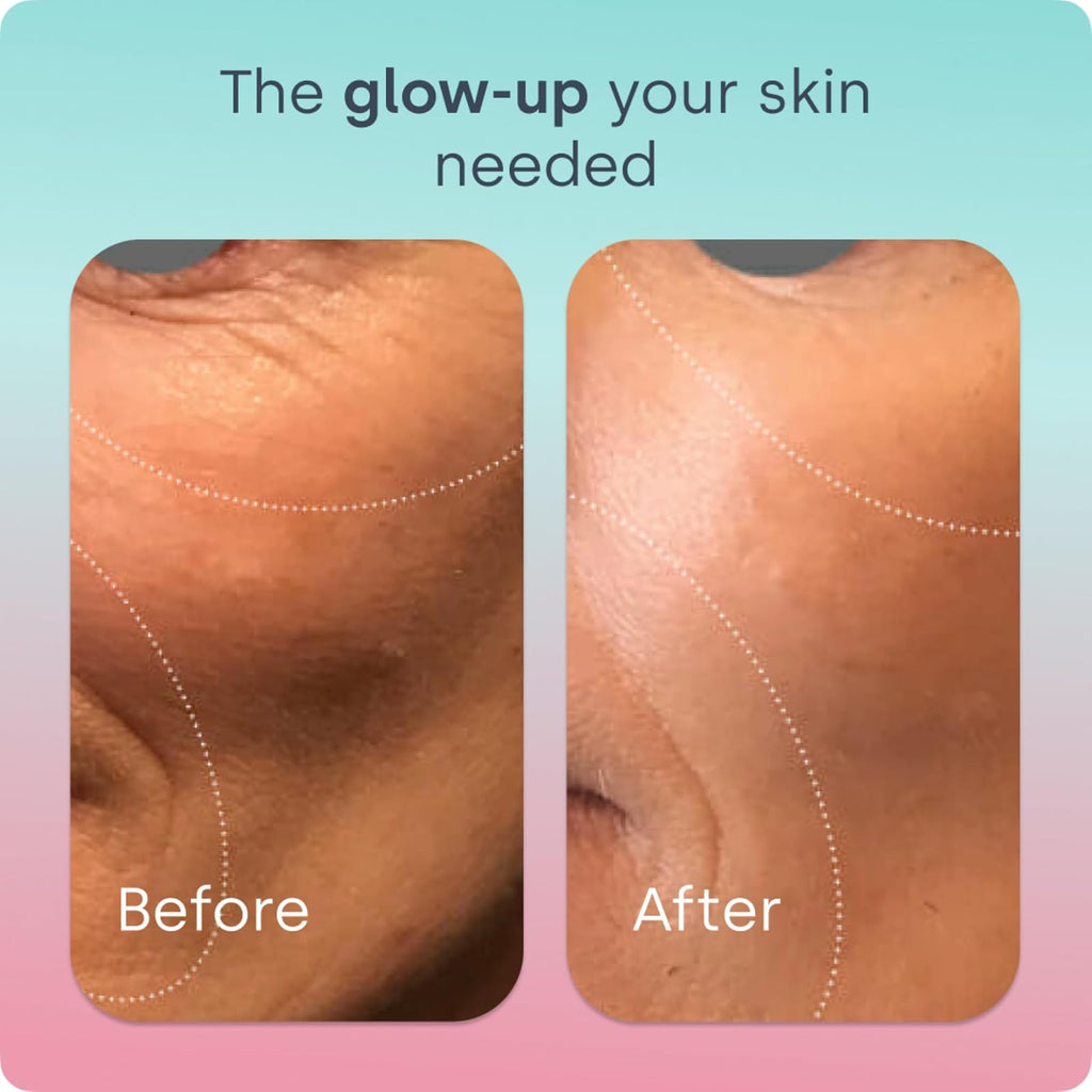 Multivitamins for radiant skin