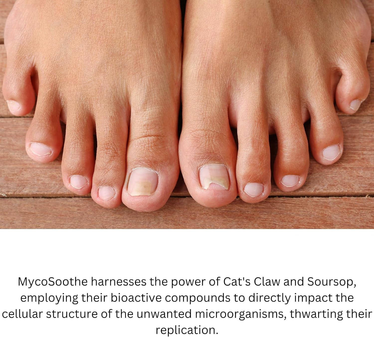 MycoSoothe advanced wellness support
