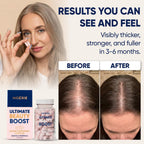 Nail strengthening supplements by Moerie
