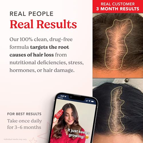 natural hair vitamins with biotin