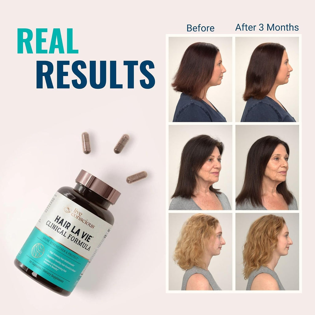 natural hair vitamins with saw palmetto