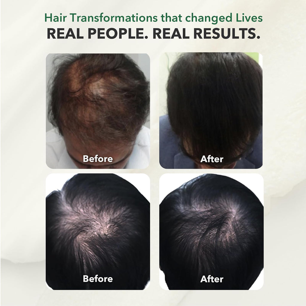 Natural hair wellness with DHT blocker