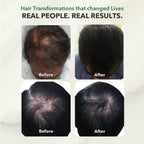 Natural hair wellness with DHT blocker