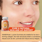 natural l-lysine gummies for cold sores