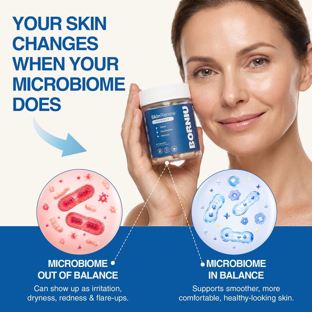 Natural probiotics for skin balance